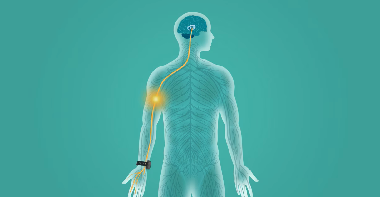 Neupulse - Improving the lives of people with Tourettes